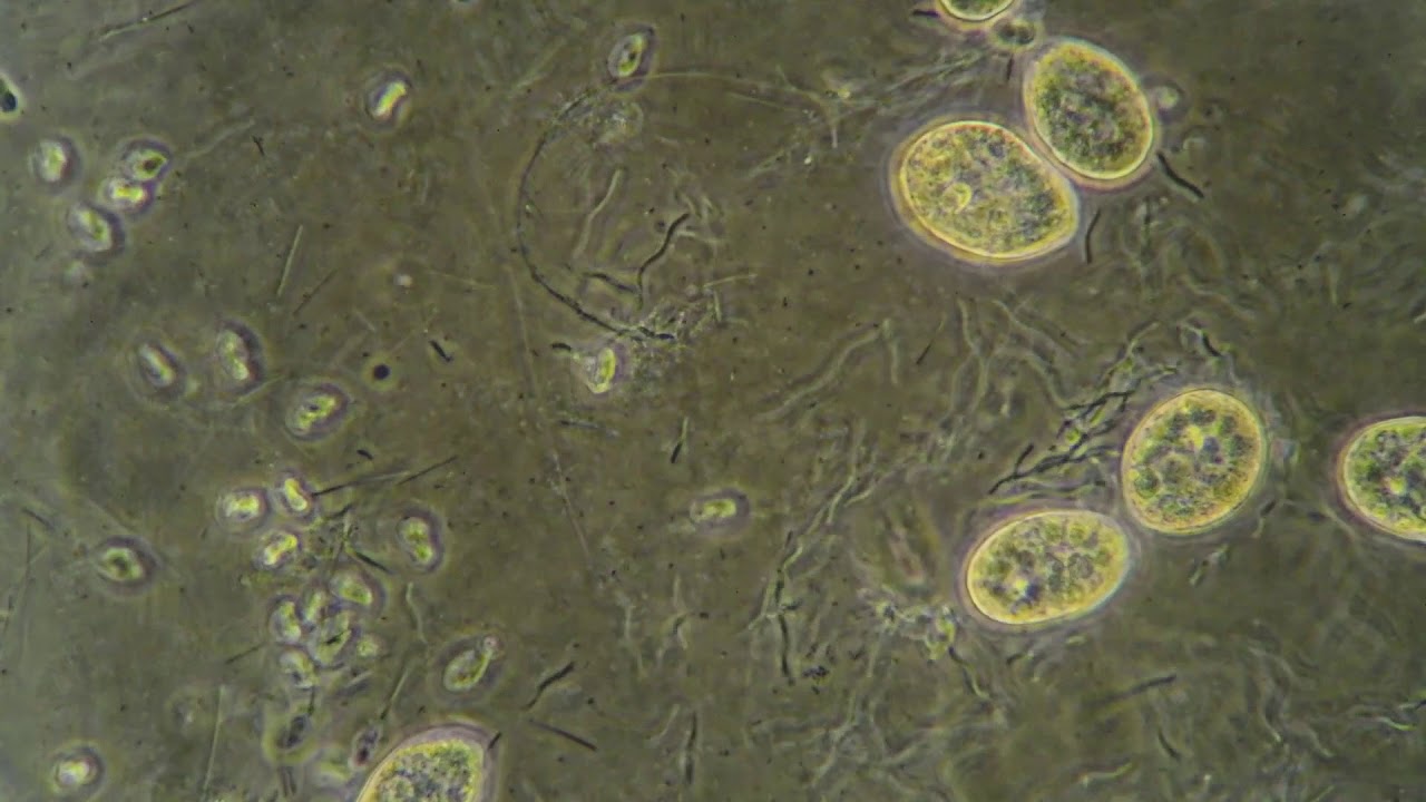 Microbial Decomposition 2 - YouTube