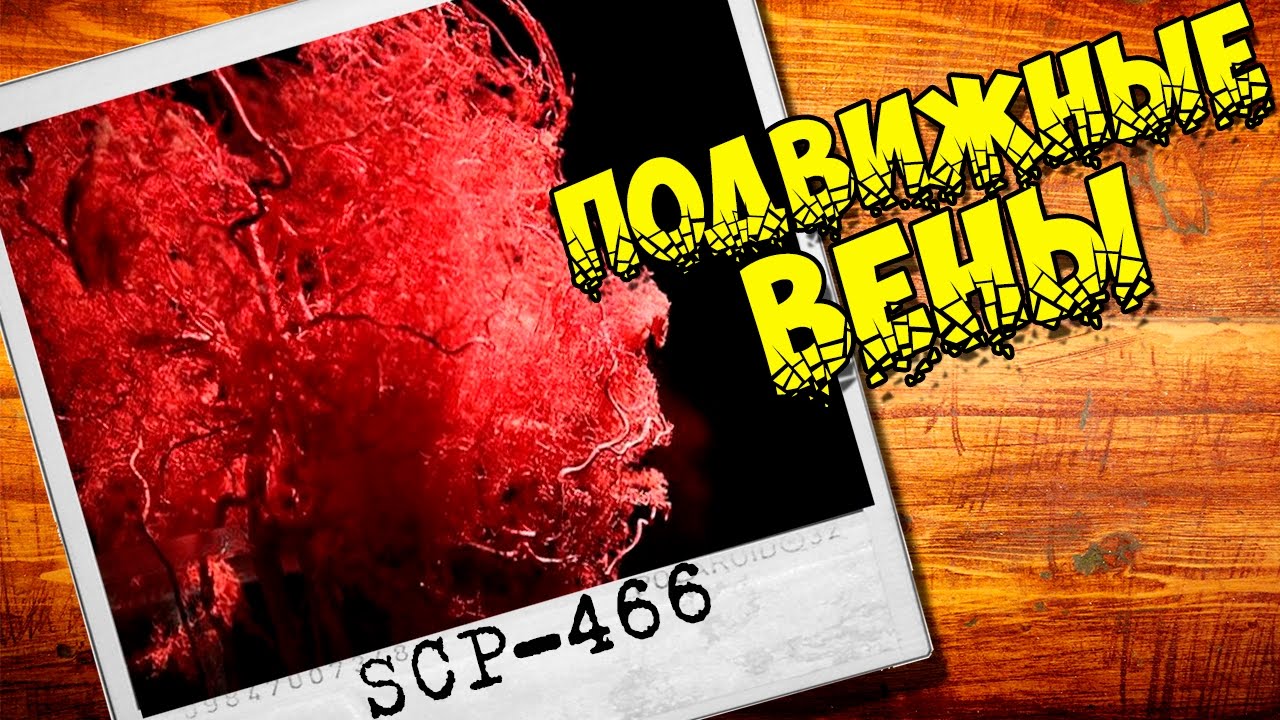SCP ИСТОРИИ : SCP 466 Подвижные вены - YouTube