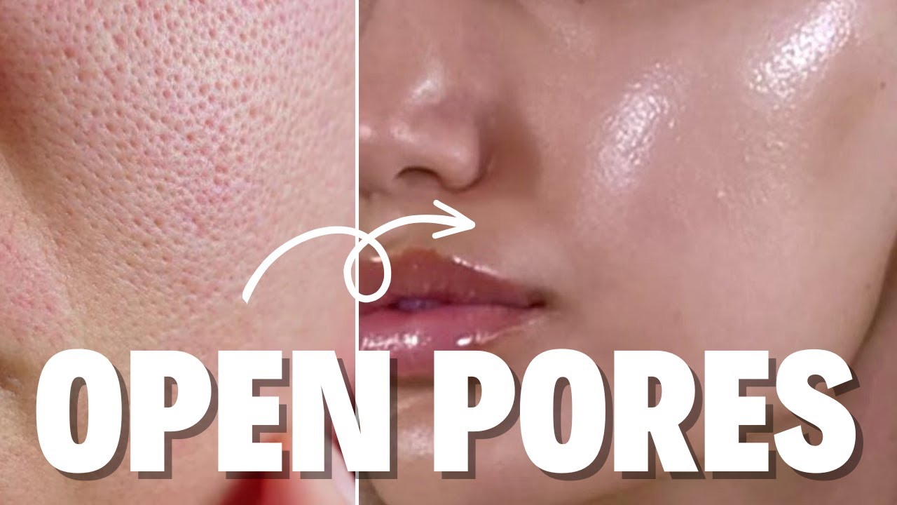 Open Pores To Flawless Skin - YouTube