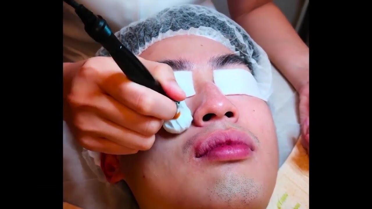 stem infusion treatment | faceofman skincare - YouTube