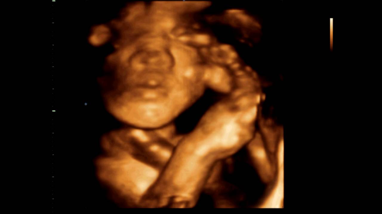 3D Ultrasound (28 weeks) 3D узи на 28 неделе беременности мальчик ...