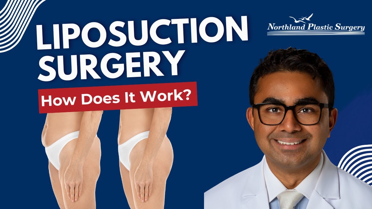 Liposuction Surgery: How Does it WORK? - YouTube