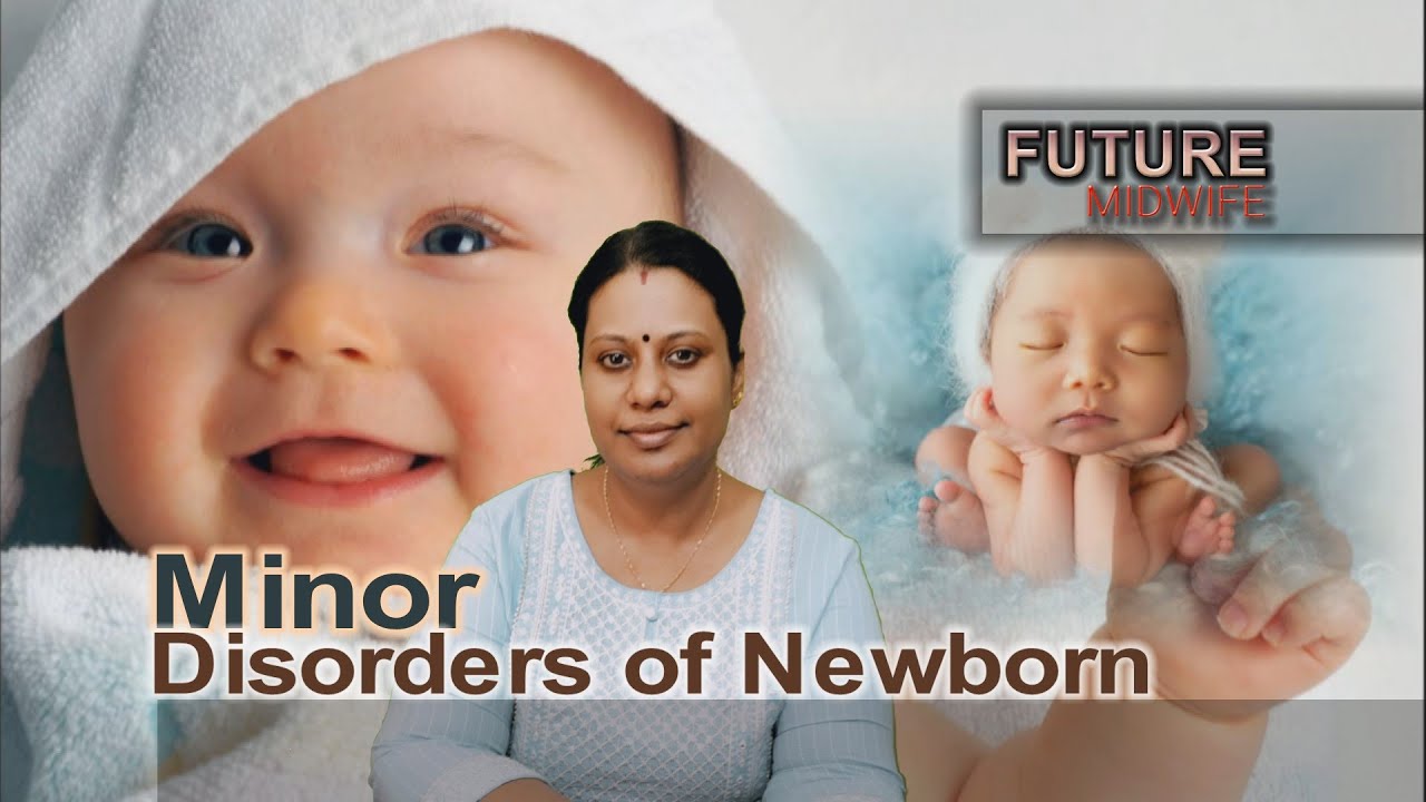 Minor Disorders of Newborn - YouTube