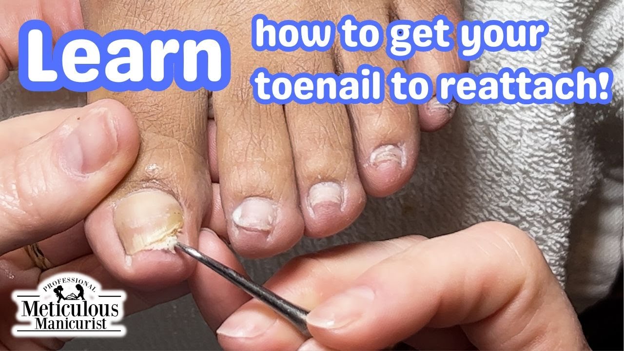 👣How To: Toenail Cleaning at Home👣 - YouTube