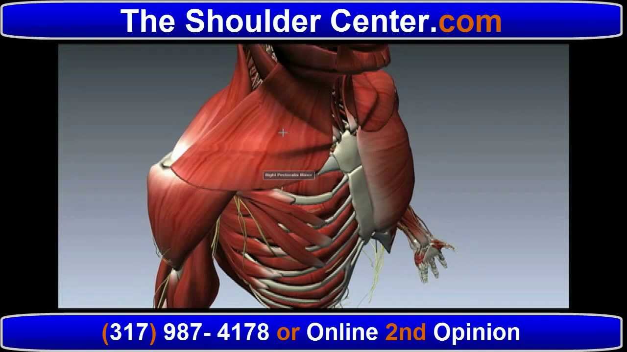 Shoulder Pain - All You Need to Know About Bursitis|Tendonitis ...