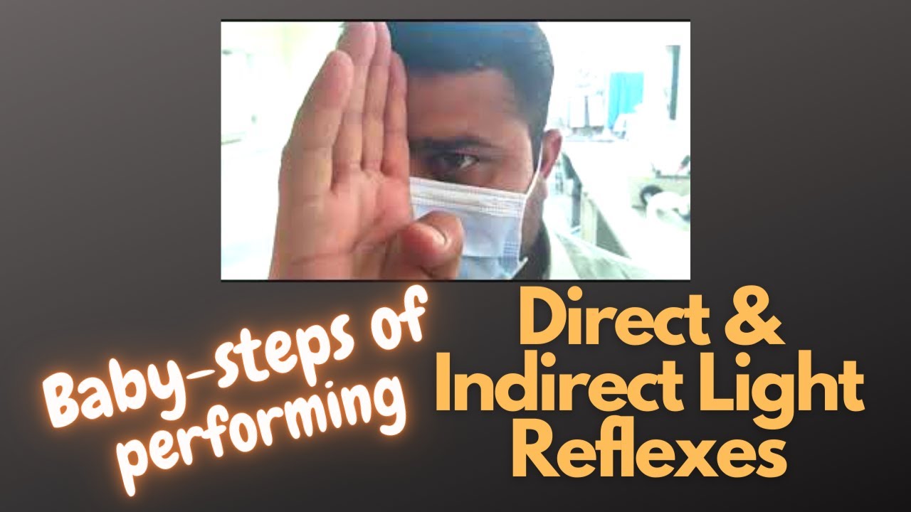 Demonstrating direct and indirect light reflexes (2nd Prof. MBBS ...