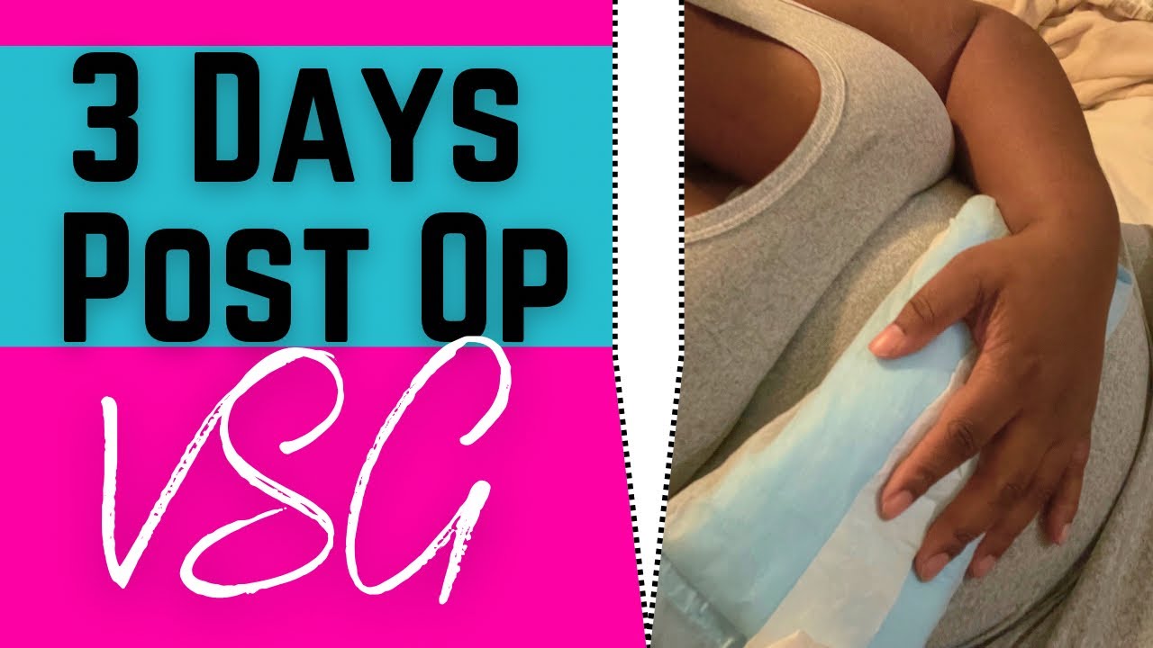 How I’m feeling 2 days post op VSG Surgery #vsg #atl #2024 - YouTube