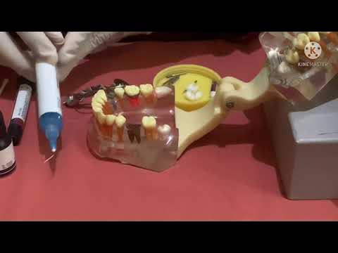 Video Simulasi Perawatan Restorasi Kavitas Klas 2 GV Black - YouTube