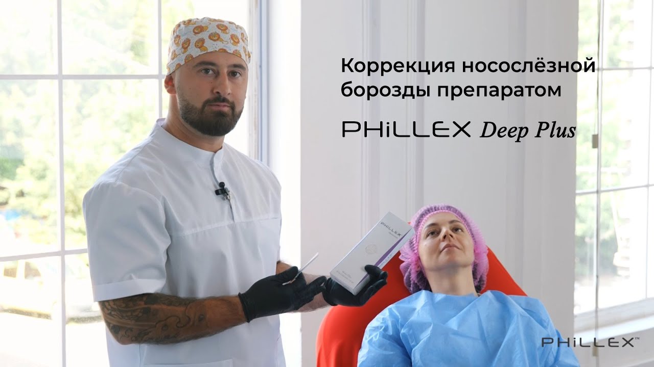Корекція носослізної борозни препаратом Phillex Deep Plus - YouTube