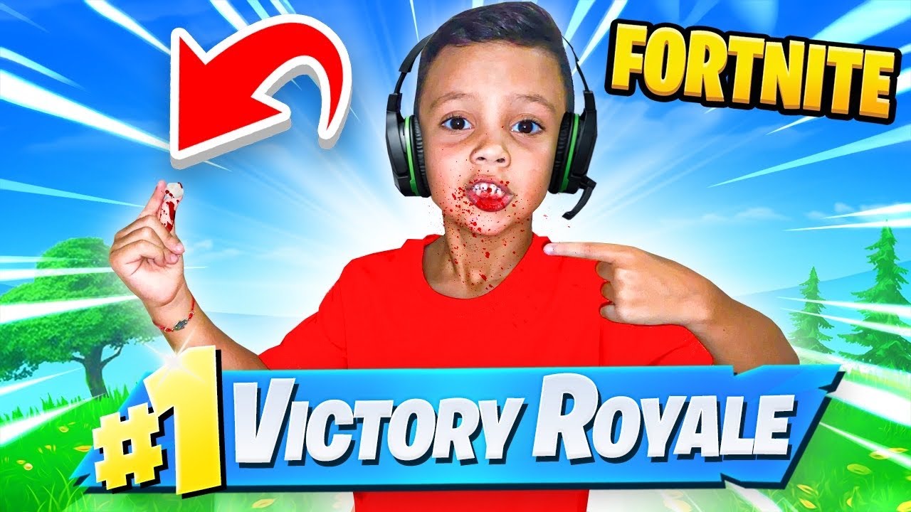 His TOOTH fell out while PLAYING FORNITE. Party of 4 Gaming - YouTube