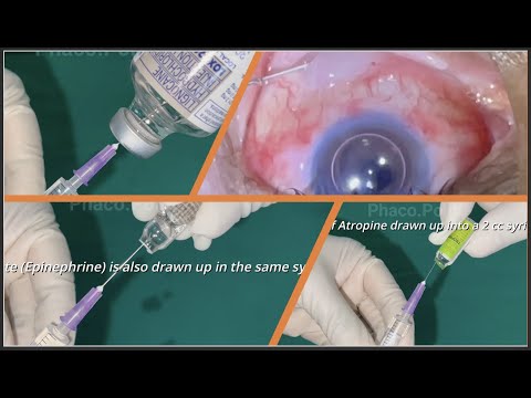 The Mydricaine injection - preparation and administration - YouTube
