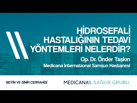 Hidrosefali Hastalığının Tedavi Yöntemleri Nelerdir?