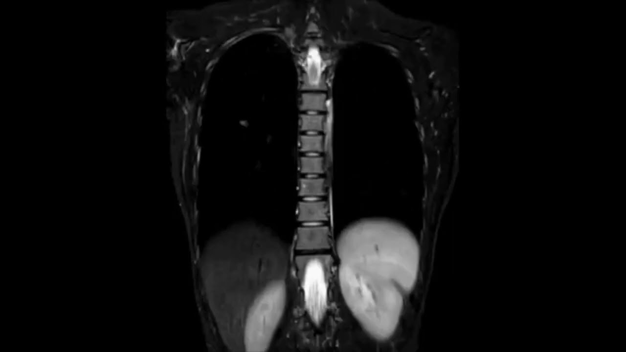 Case 5 - Radiology Case Series - YouTube