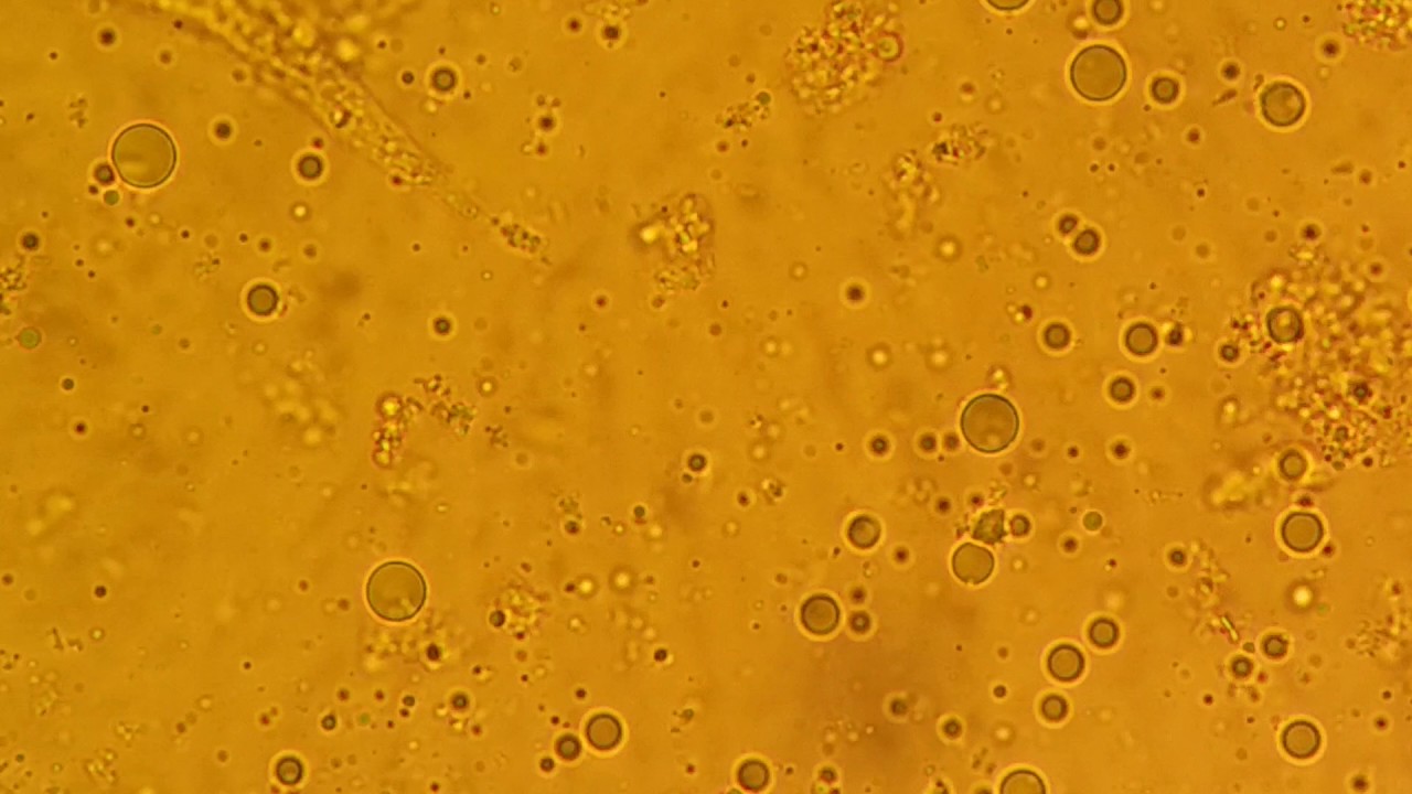 Strongyloides stercoralis filariform larvae - YouTube