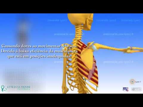 Ombros protusos - YouTube