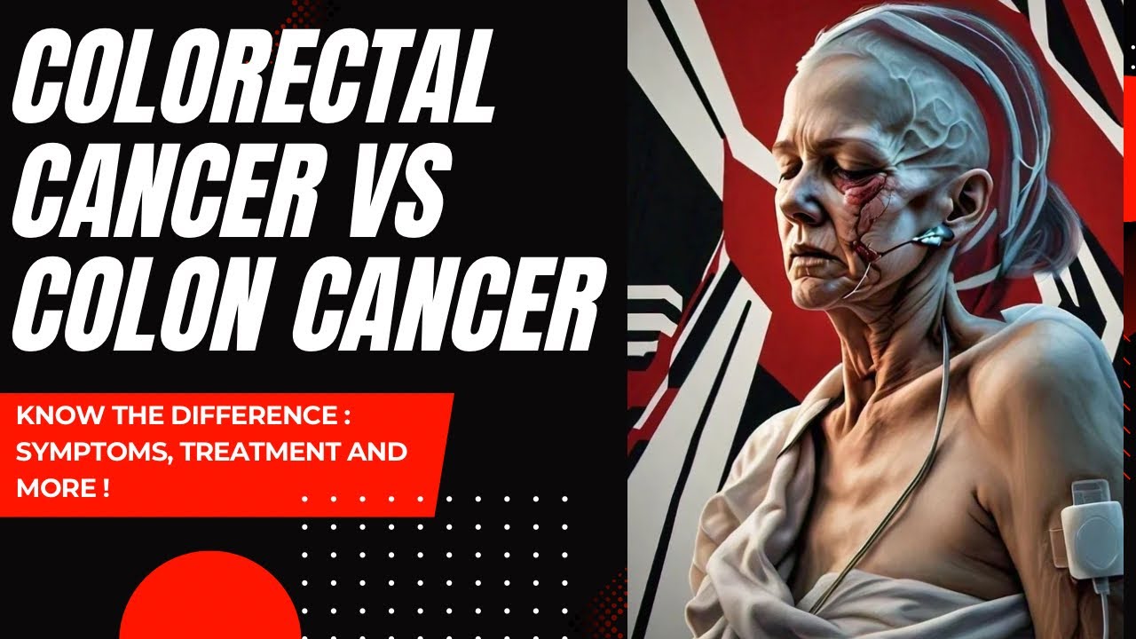 COLORECTAL CANCER vs COLON CANCER : Key Symptoms, Insights, and the ...