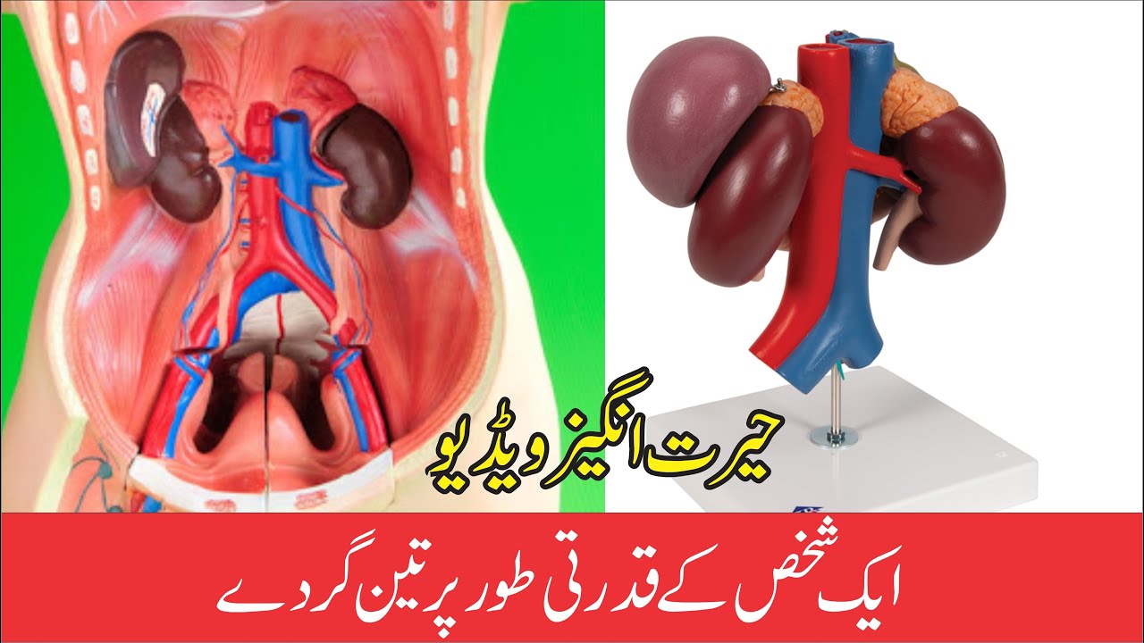 Unbelievable News A Man Have 3 Kidneys - YouTube