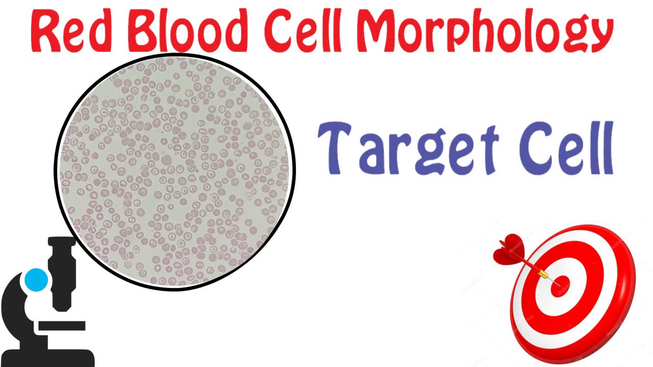Red Blood Cell Morphology Part 3 - Target cell - YouTube