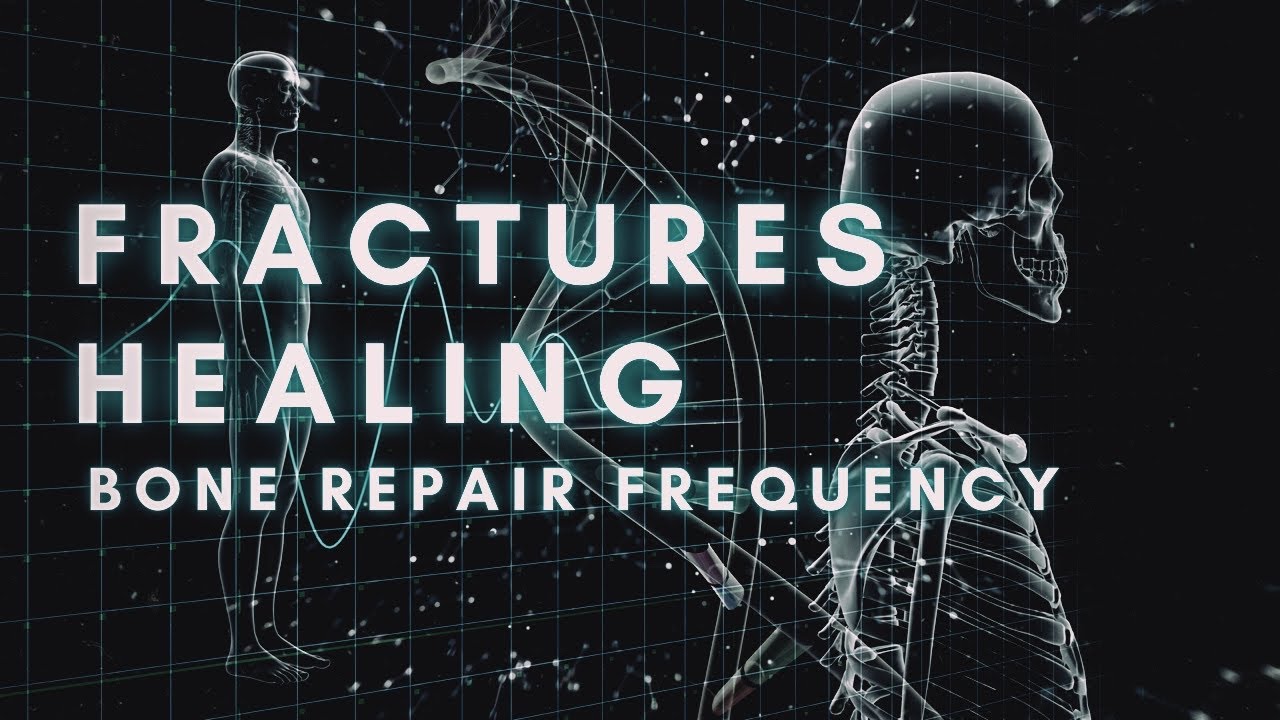 [Fractures Healing] - Rife Frequency Treatment | Bone Regeneration And ...
