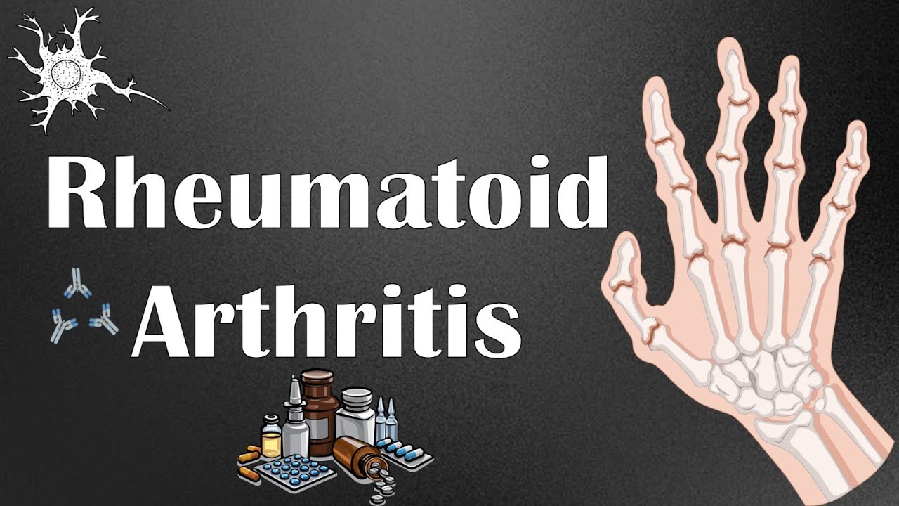 Rheumatoid athritis | RA | Rheumatoid Athritis Symptoms | Treatments ...
