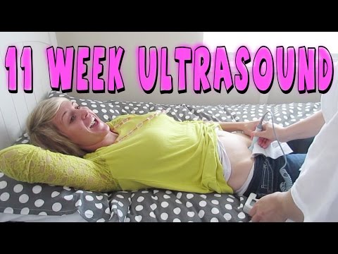 11 WEEK ULTRASOUND - PREGNANCY UPDATE