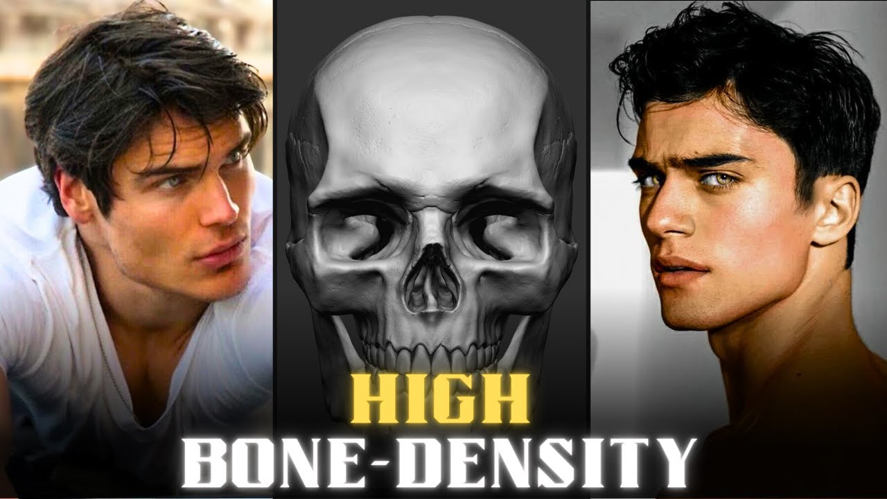 5 signs you have High Bone Mass - YouTube