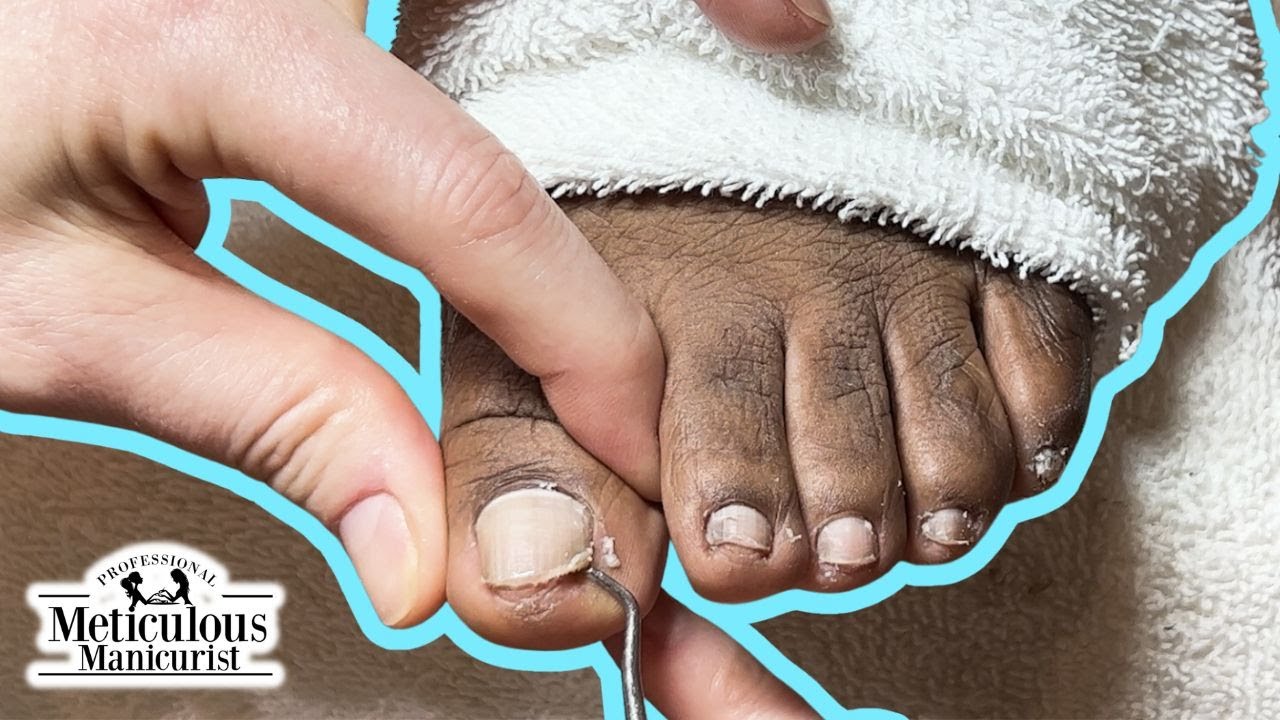 Toenail Cleaning Pedicure at Home - YouTube