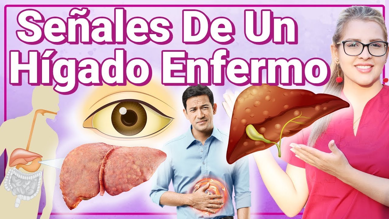 Señales De Que Tu Hígado Pide Ayuda - Cómo Saber Si El Higado Está ...
