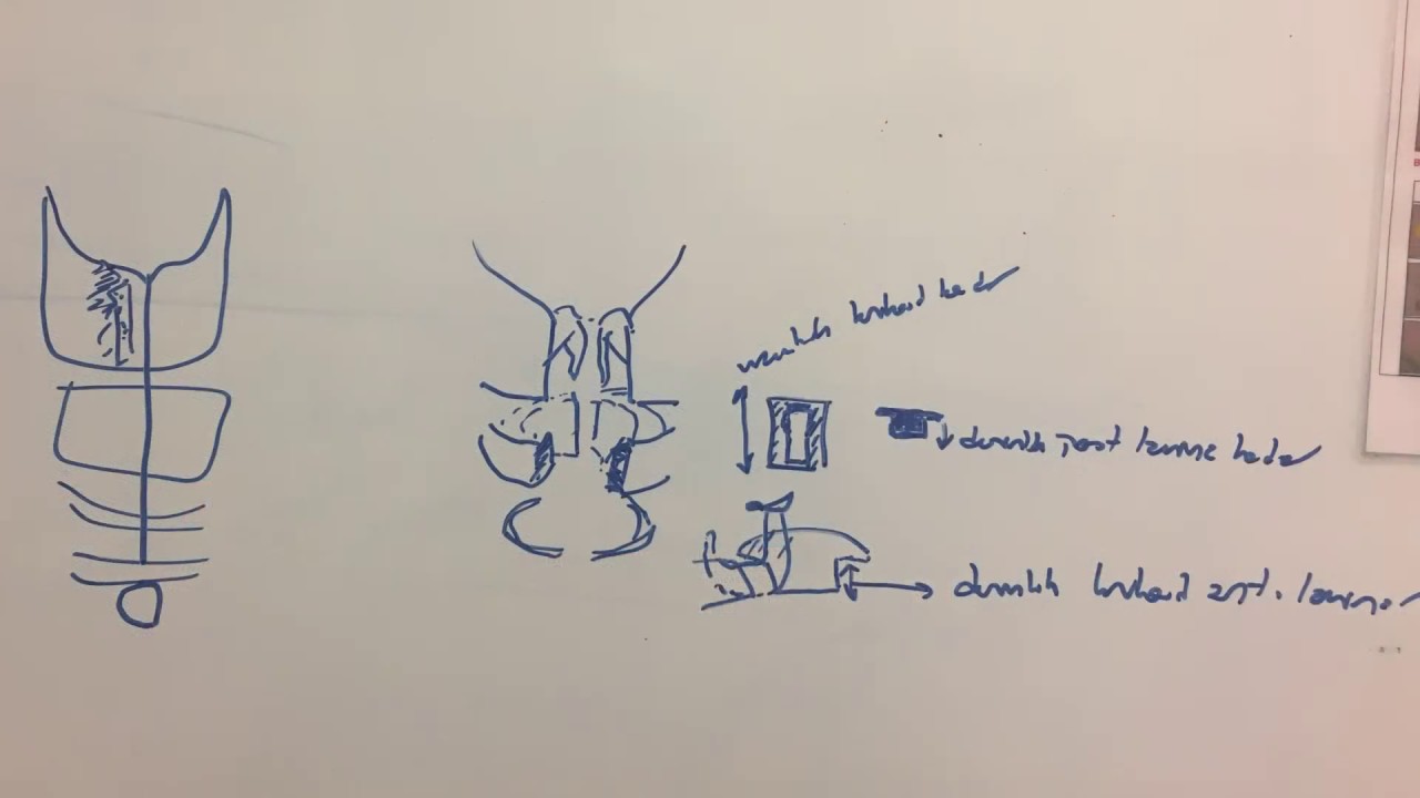 APCCG rutter stent Dr Ozan Gökler - YouTube