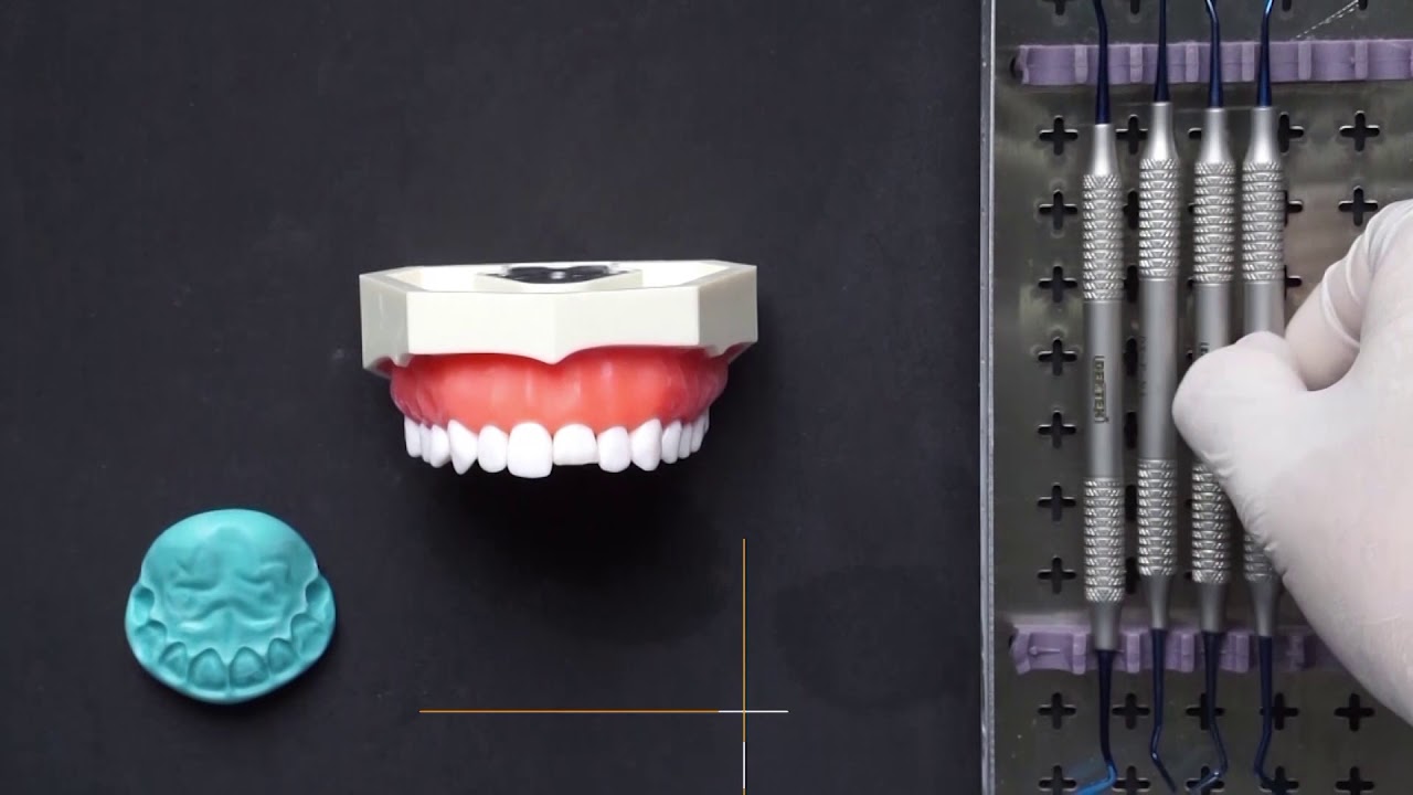 Esthetic Composite Kit - YouTube