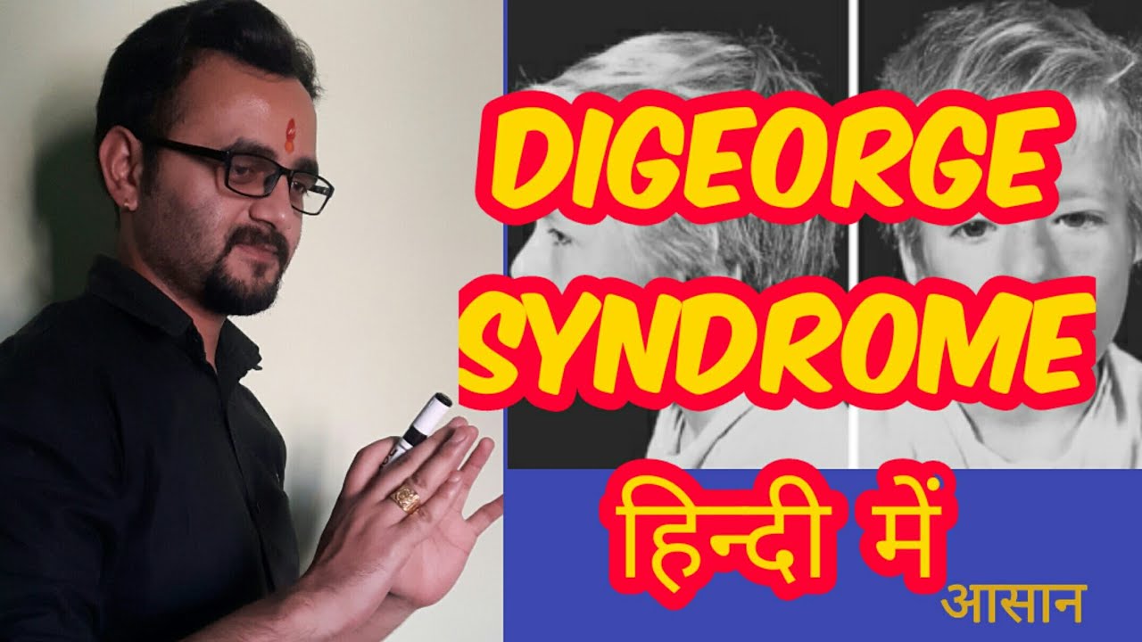 DiGeorge syndrom (22q11.2 deletion), symptoms, pathology, diagnosis and ...