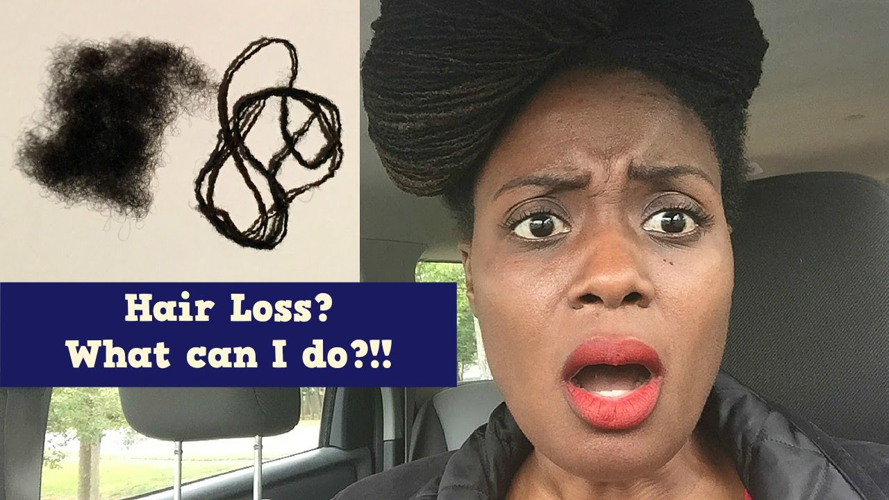 Hair Loss| Natural Hair Locs and How to Address It - YouTube