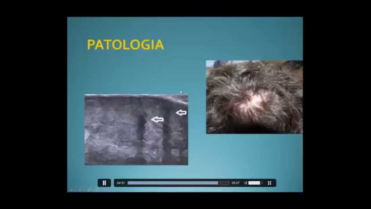 ¿ Cómo se ve la piel y anejos en ecografía cutánea? - YouTube