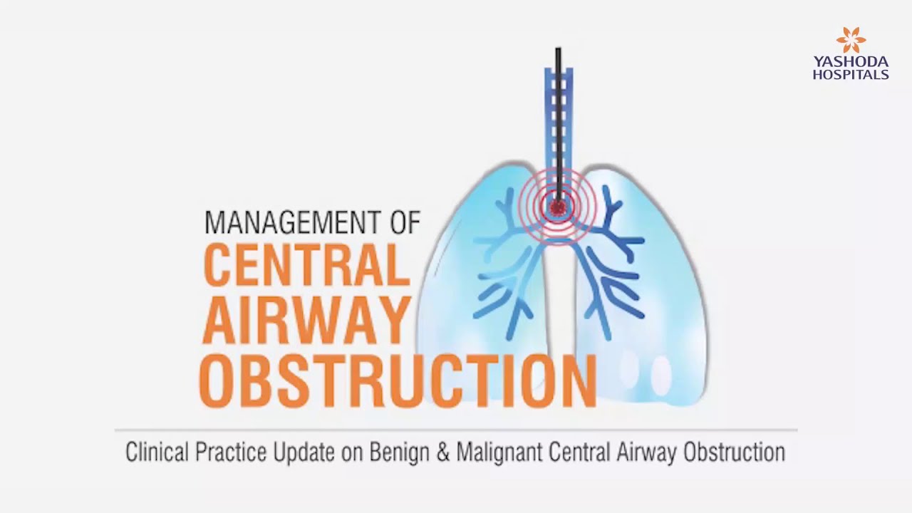 Central Airway Obstruction | Interventional Pulmonology Virtual Meet ...