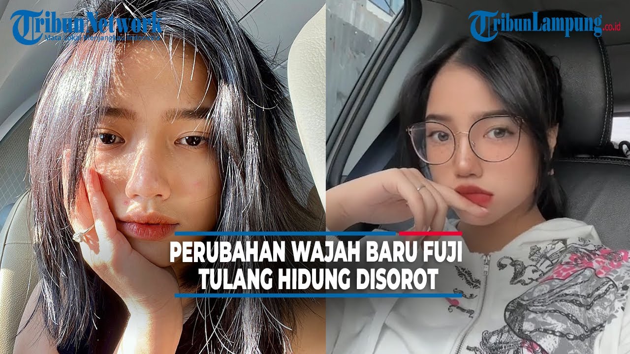 Perubahan Wajah Lama Fuji ke Wajah Baru, Tulang Hidung Curi Perhatian ...
