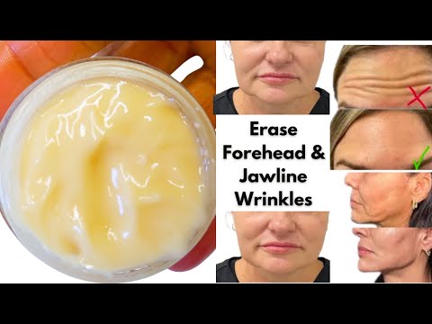 Erase Forehead Wrinkles, Lift a Sagging Jawline & Smooth Deep Laugh Lines—Naturally at Home