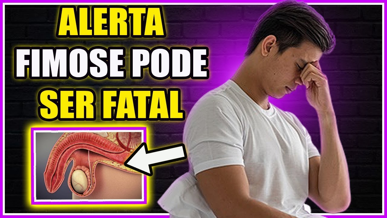 ALERTA ! CONHEÇA O MAIOR RISCO QUE A FIMOSE PODE CAUSAR / SE VOCÊ TEM ...