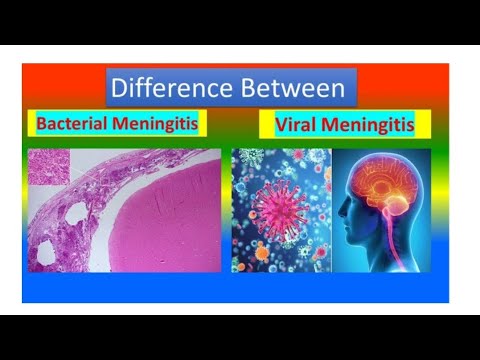 BACTERIAL MENINGITIS VS VIRAL MENINGITIS || PATHOPHYSIOLOGY|| CLINICAL ...