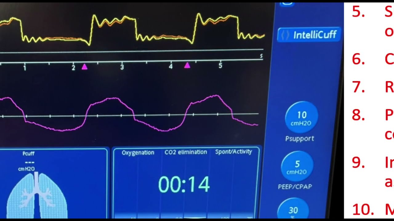 #e293 Preview: Mechanical Ventilation: Understanding Settings, In-Line ...