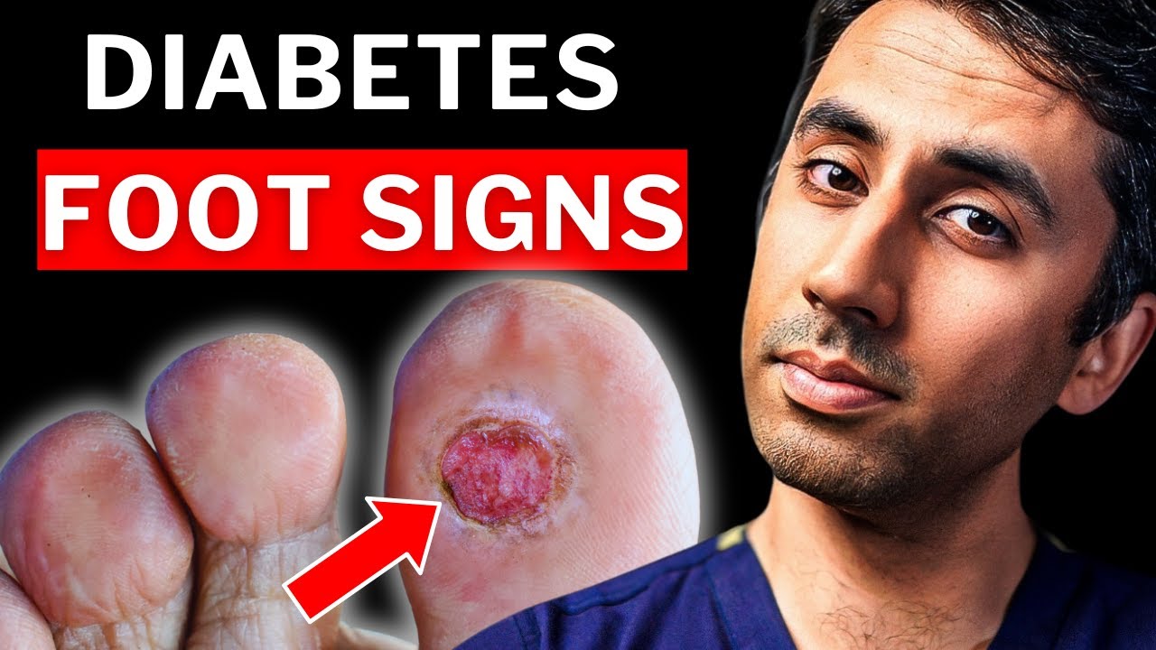 8 Warning Signs Your Feet Give You About Diabetes (Never Ignore These ...
