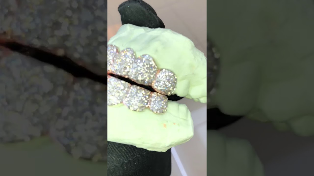 Rose gold diamonds grillz - YouTube