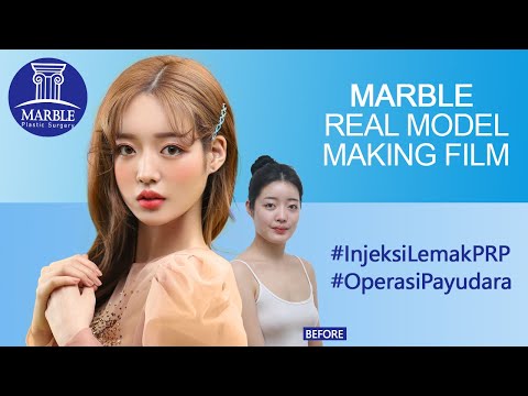 Yuk Intip Bareng Lokasi Photoshoot Model Injeksi Lemak PRP & Operasi Payudara Marble Plastic Surgery