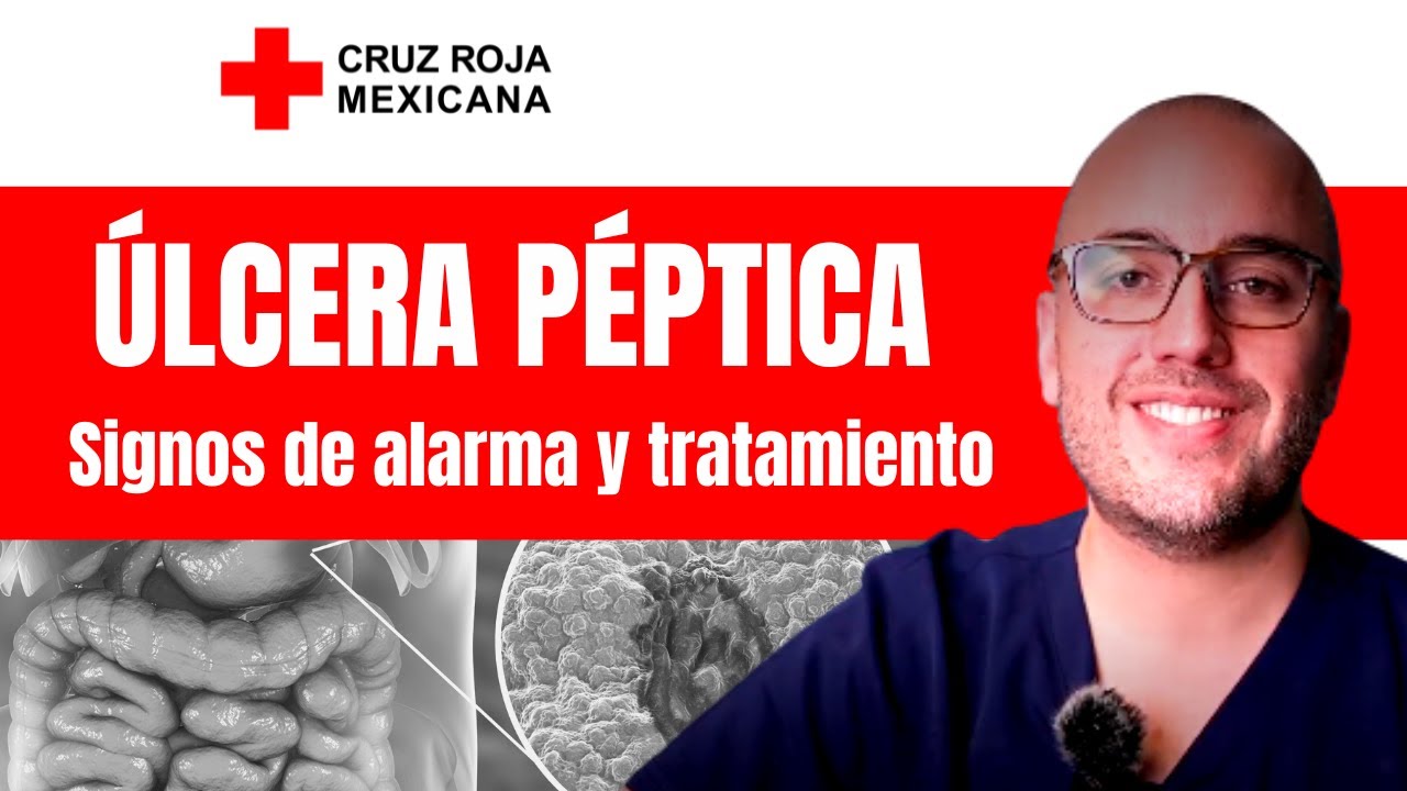 ¿Cuáles son los signos de alarma y tratamiento de las ulceras pépticas ...
