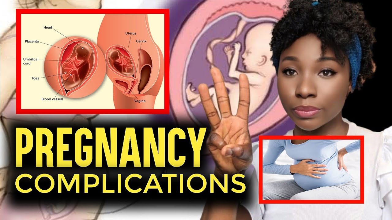 3 COMMON CONDITIONS IN PREGNANCY THAT CAN LEAD TO COMPLICATIONS - YouTube
