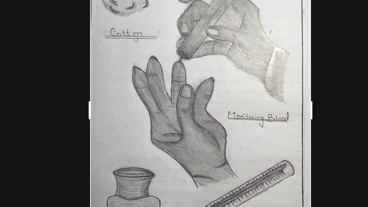 Obtaining Blood By Pricking Method||Physiology Practical||Experiment #2 ...