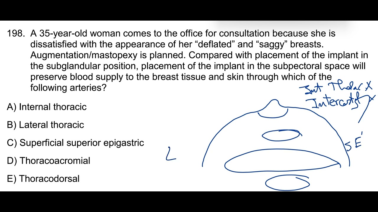 Implant & Breast Subglandular & Subpectoral Blood Supply - Plasticology ...
