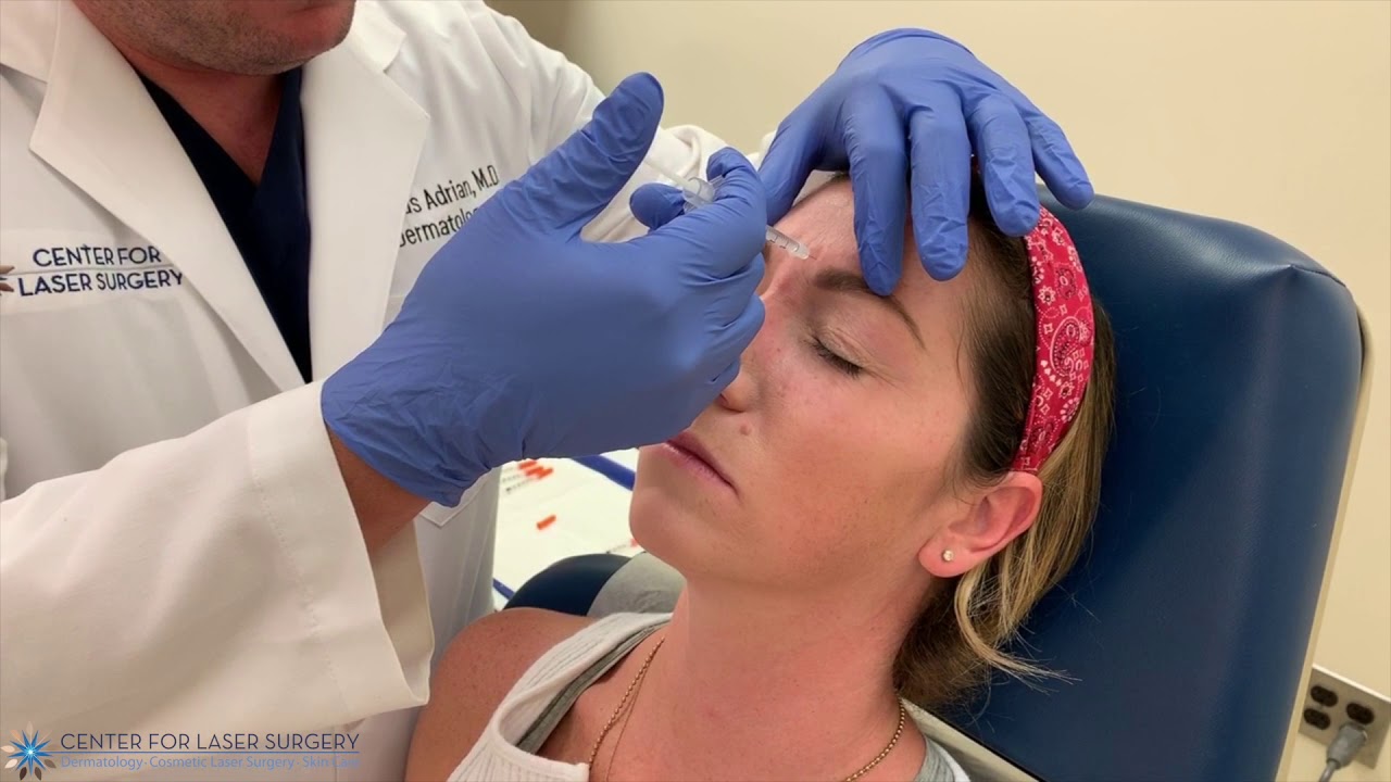 Botox Treatment of Glabellar Lines - YouTube