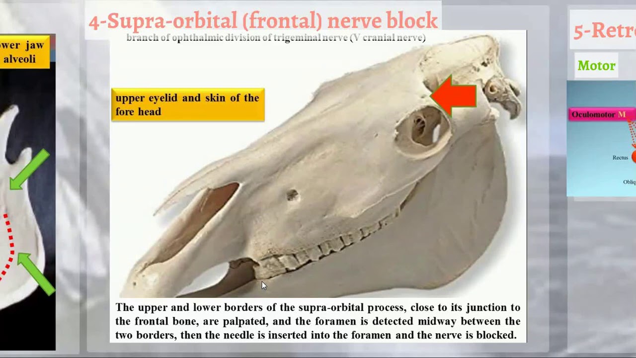 II-REGIONAL ANALGESIA I-PERI-NEURAL A-Regional Analgesia of Head 1 ...