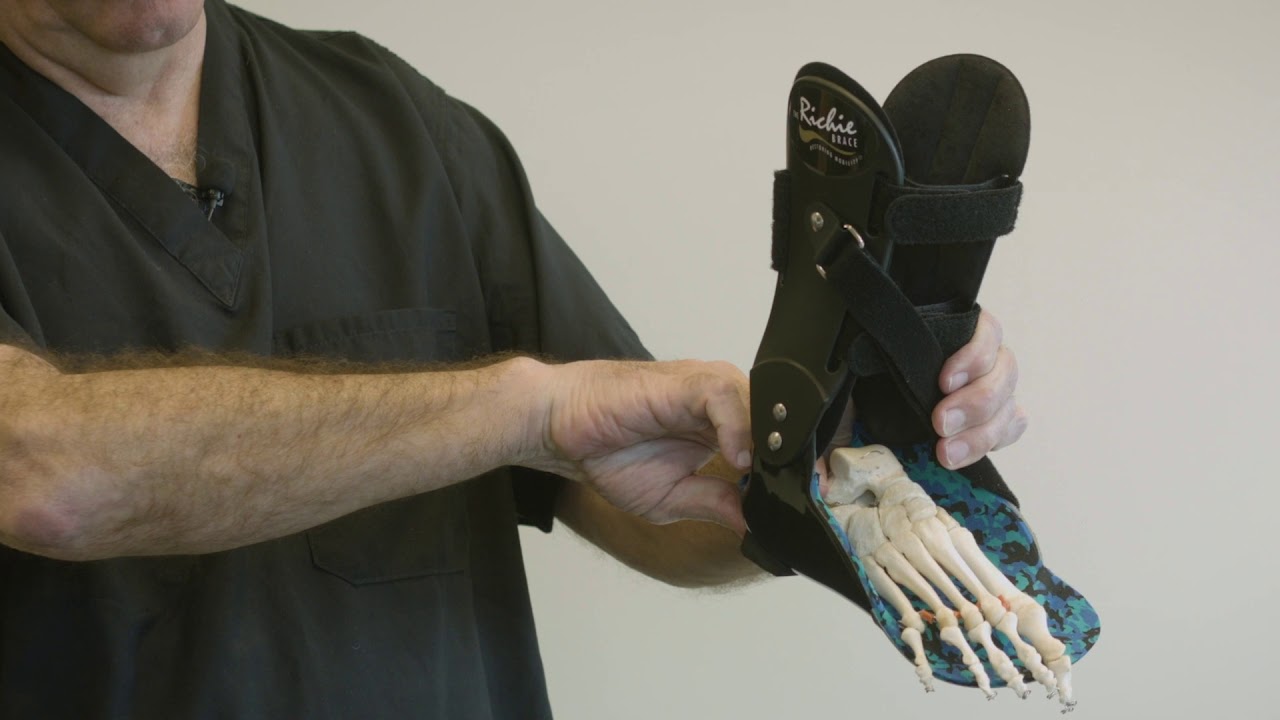 Clinical Pearls of AFO Therapy - Flanges and Suspenders - YouTube