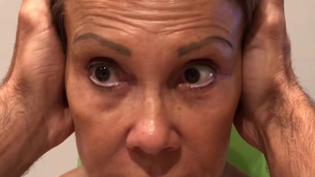 Halmagyi Test o Head Impulse Test: Neurotomía vestibular - YouTube